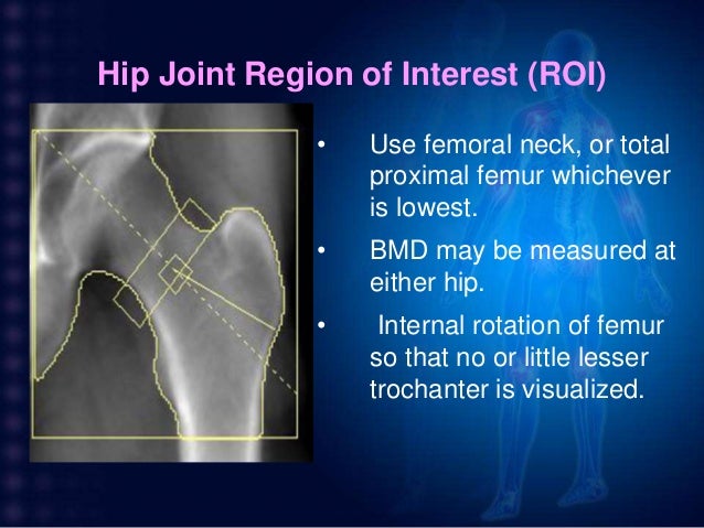 Bone Mineral Density