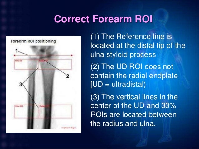 Bone Mineral Density