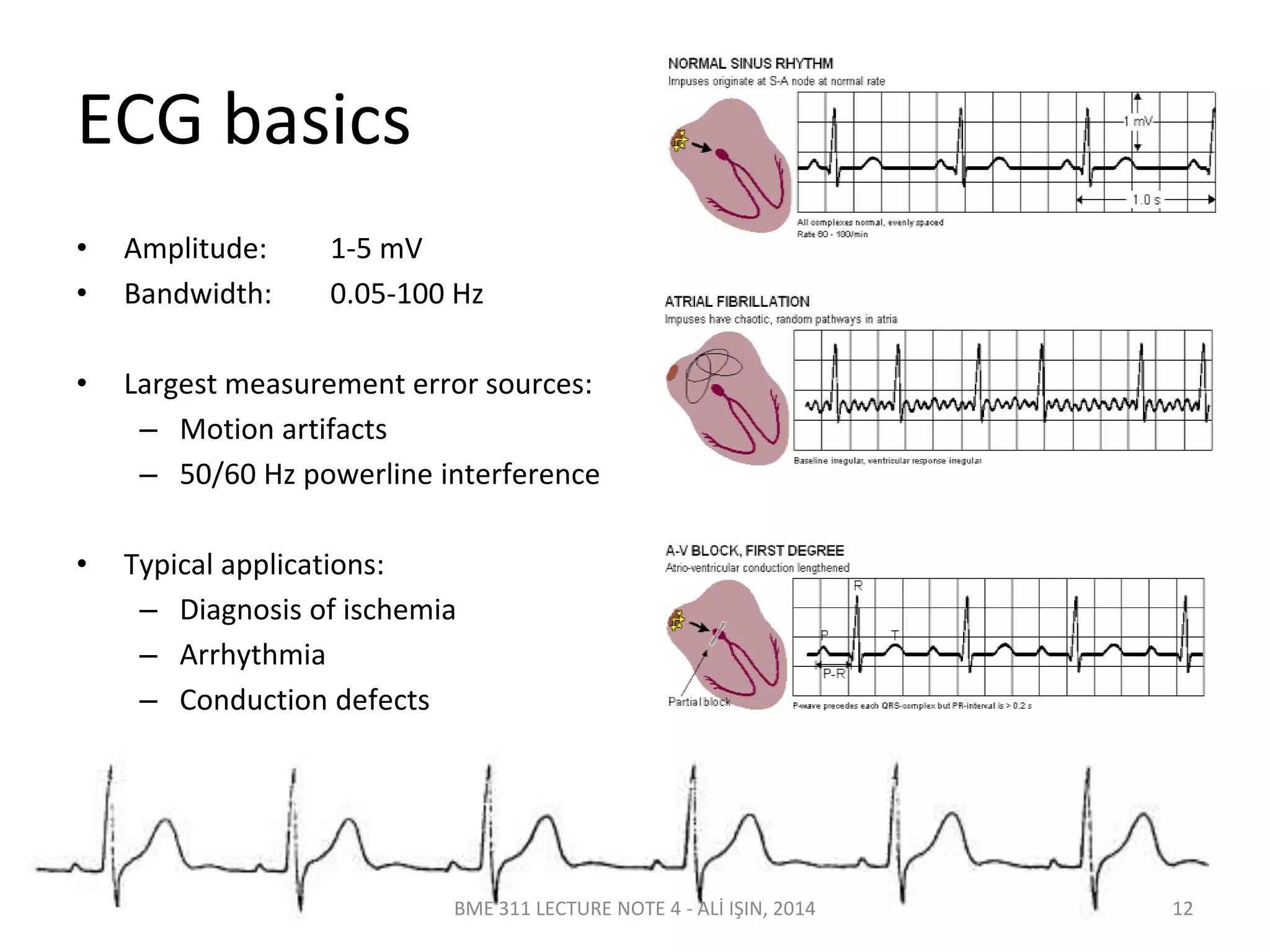 BME 311 Lecture Note 4-ECG Systems_11.pptx