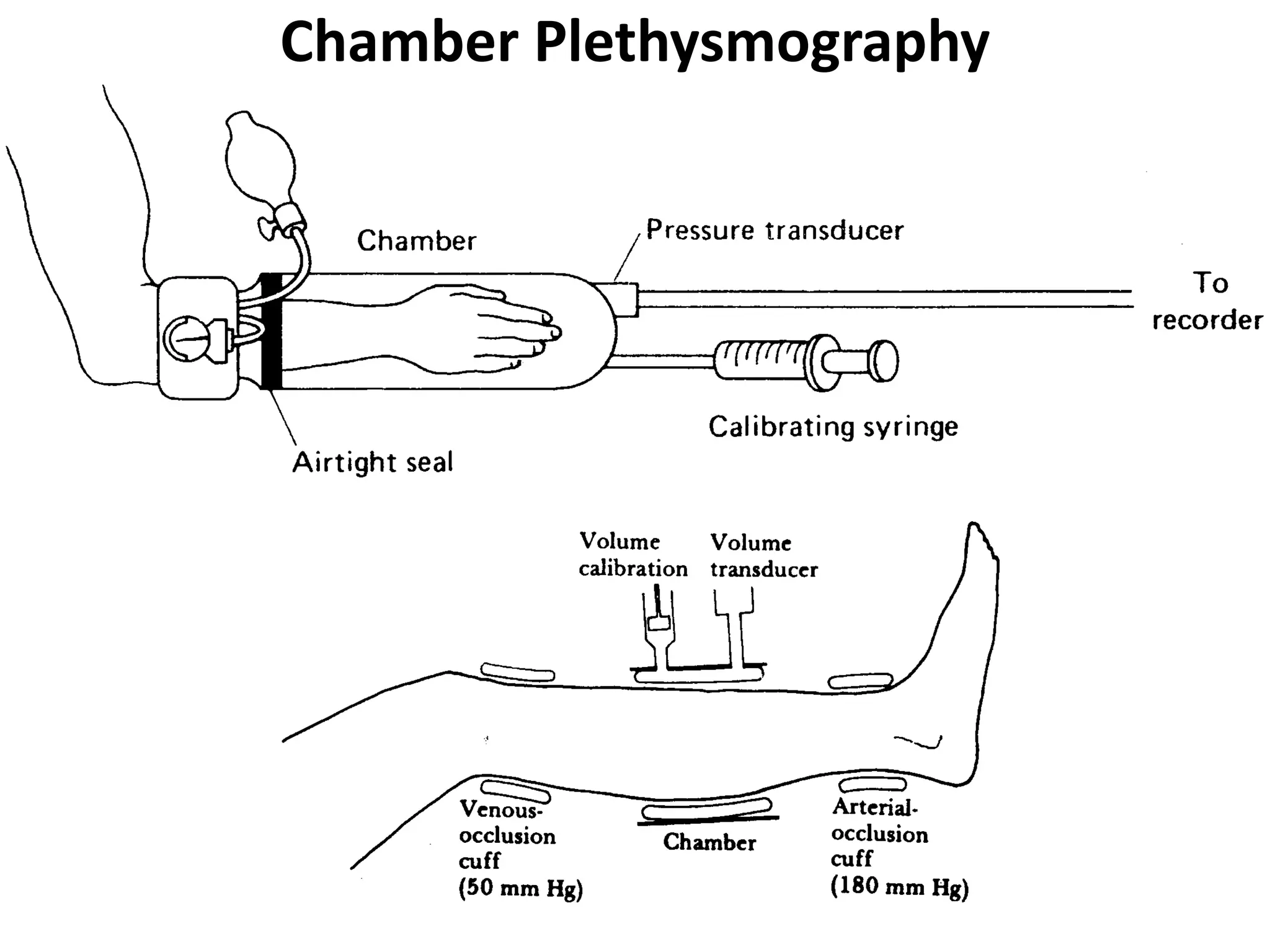 photoplethysmogram | PPT