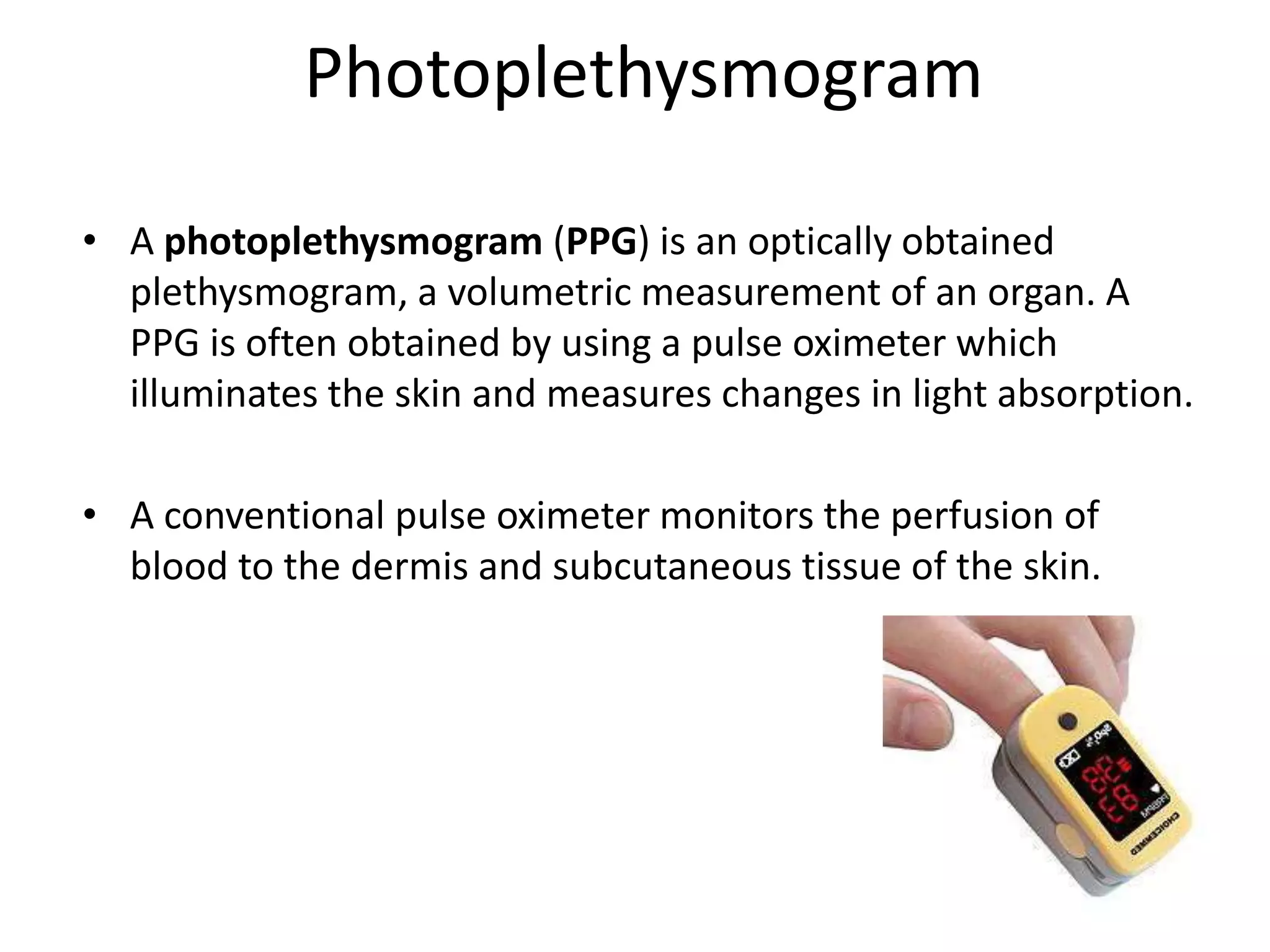 photoplethysmogram | PPT