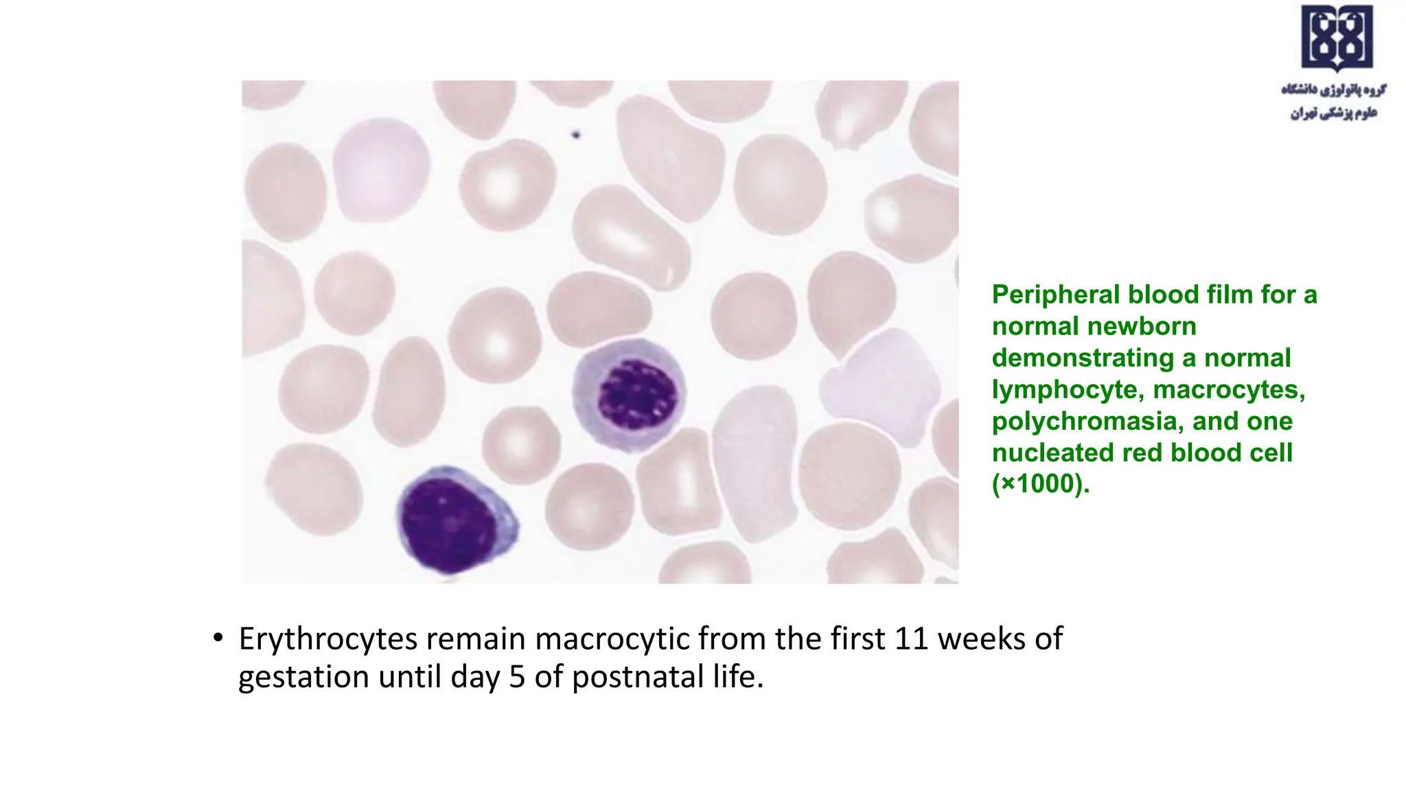 Bone Marrow evaluation EVALUATION (PBS+BMA).pptx
