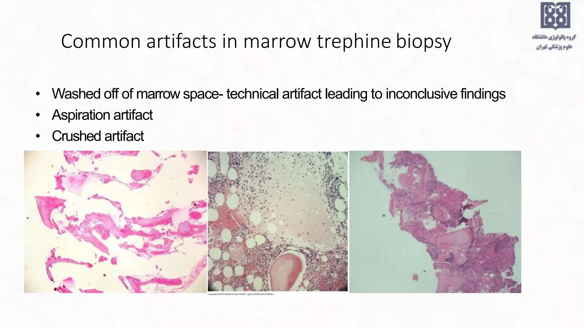 Bone Marrow evaluation EVALUATION (PBS+BMA).pptx