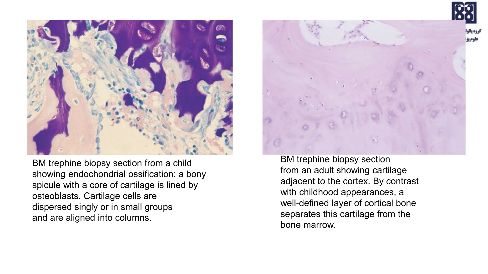 Bone Marrow evaluation EVALUATION (PBS+BMA).pptx
