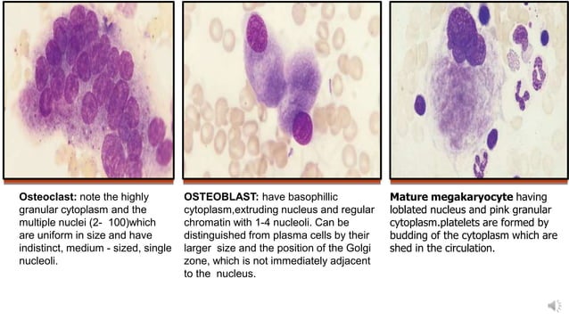 Bone Marrow evaluation EVALUATION (PBS+BMA).pptx