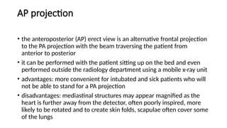 Chest Xray reading 101 or Chest Radiography | PPTX