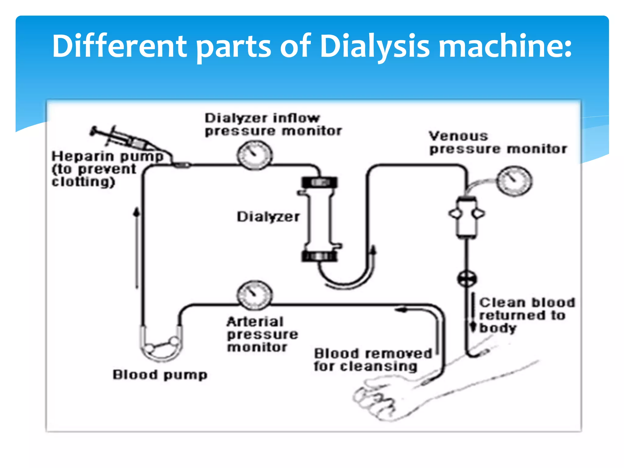 Electronics in Dialysis System | PPTX