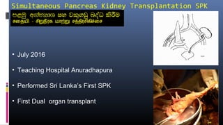 Transplantation in Sri Lanka | PPT