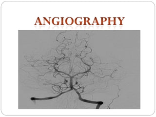 Angiography and angioplasty, basic principles.ppt