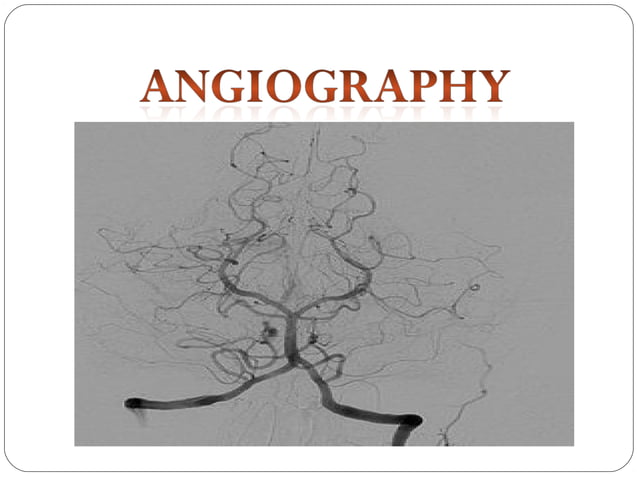 Angiography and Angioplasty | PPT