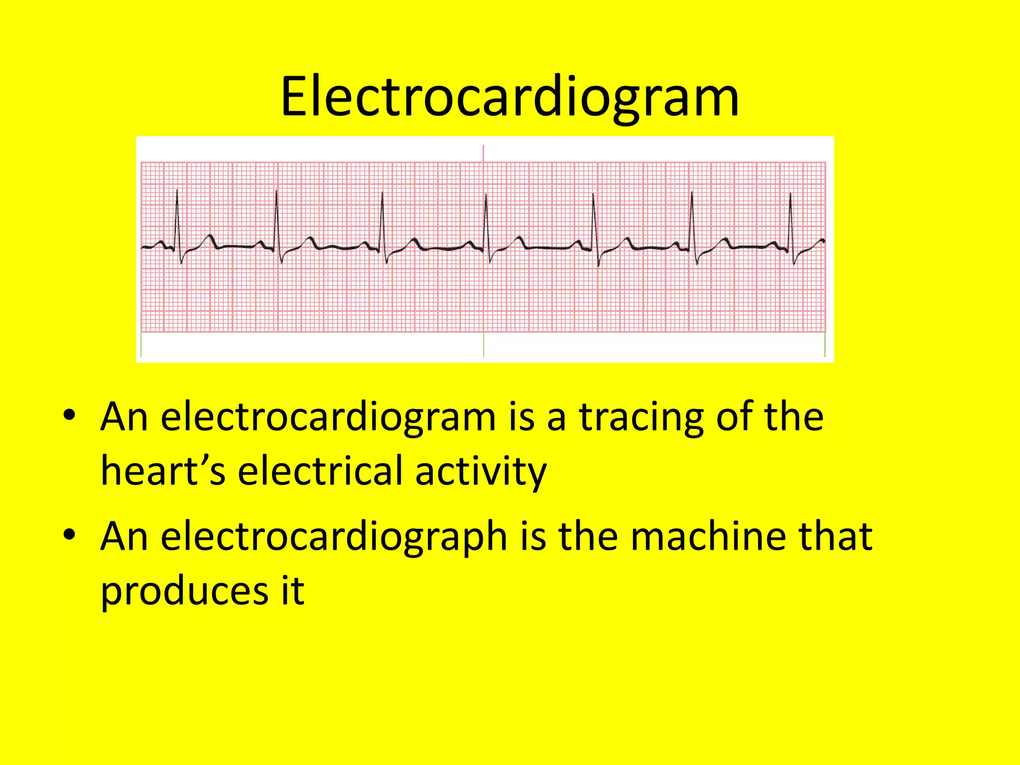 Electrocardiogram pptx | PPT