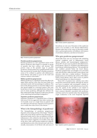 Bmj33300181 | PDF | Digestive Disorders | Diseases and Conditions