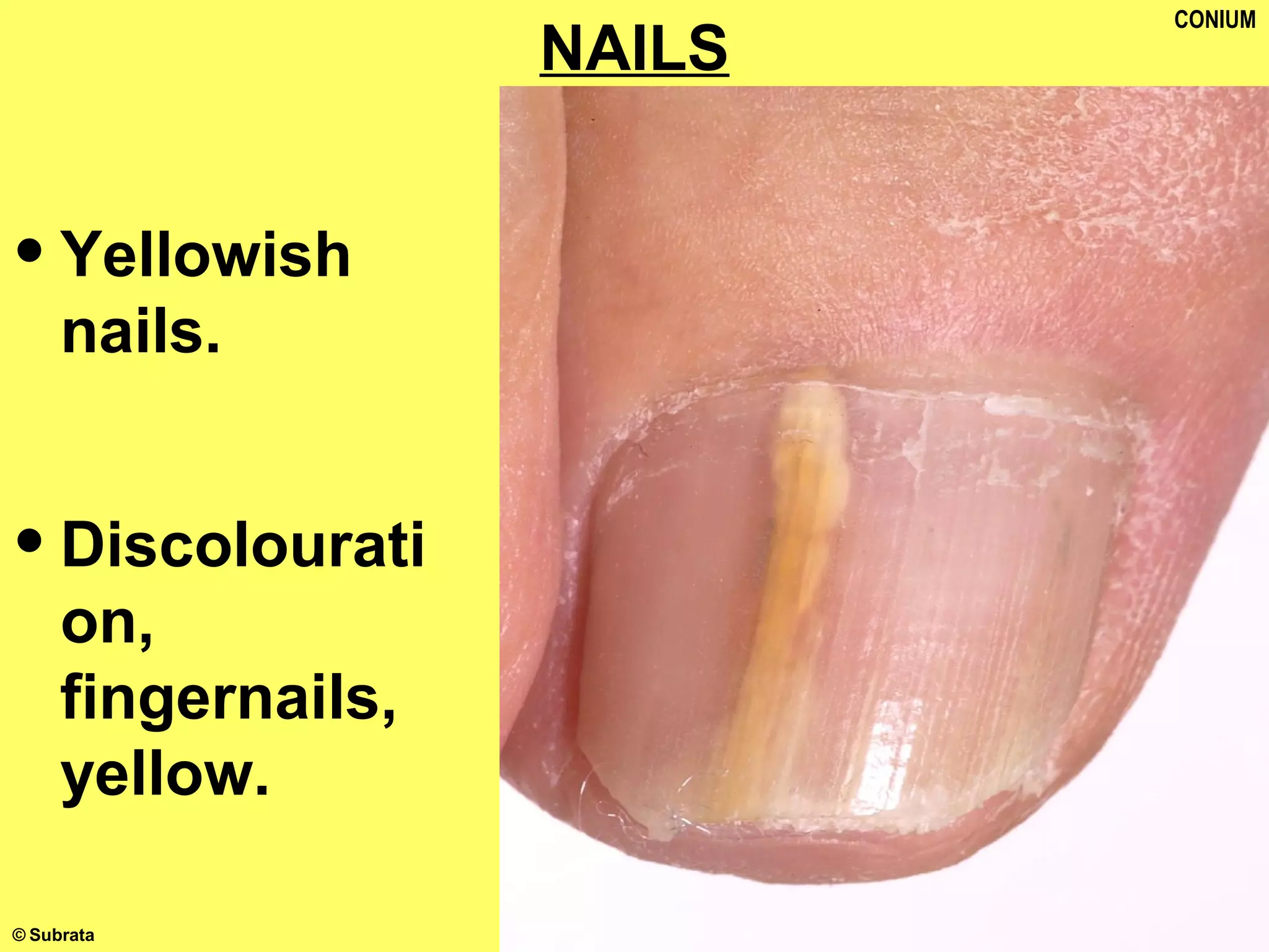 Bmm conium mac | PPT