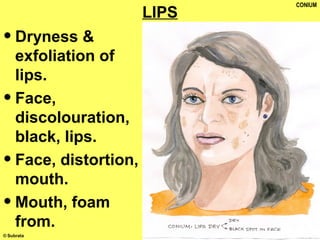 Bmm conium mac | PPT