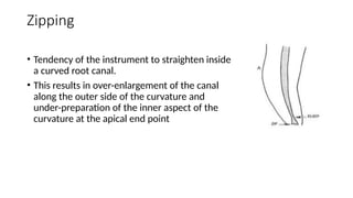 Techniques of Biomechanical preparation and different types | PPTX