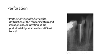 Techniques of Biomechanical preparation and different types | PPTX