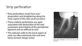 Techniques of Biomechanical preparation and different types | PPTX
