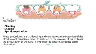 BIO MECHANICAL PREPARATION IN ROOT CANAL TREATMENT.pptx