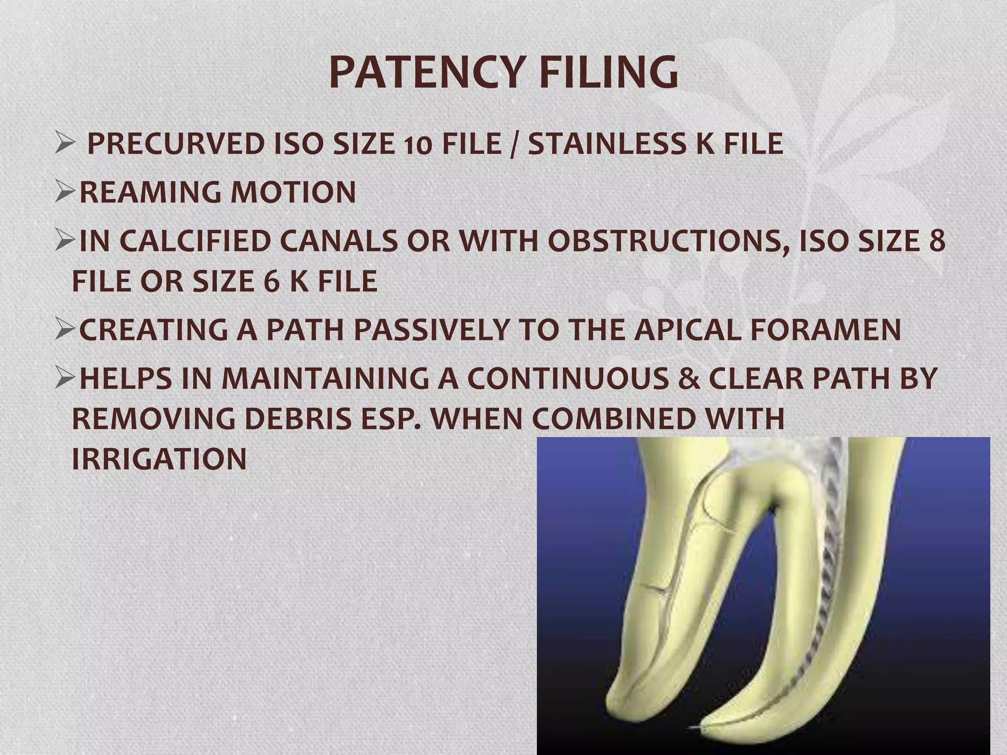 Biomechanical preparation in endodontics | PPTX