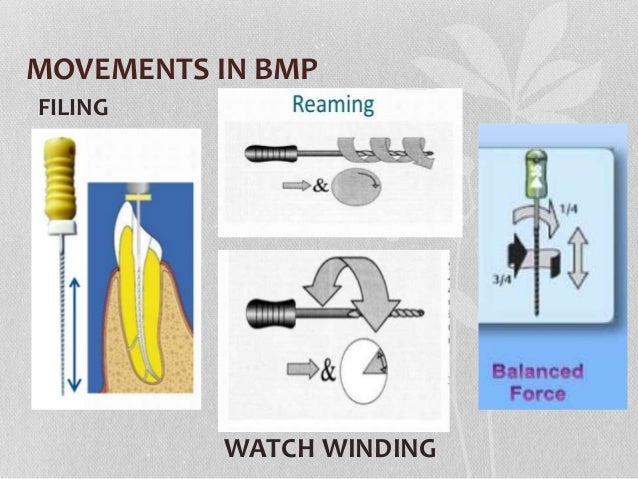 Biomechanical preparation in endodontics
