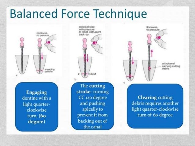 Biomechanical preparation in endodontics