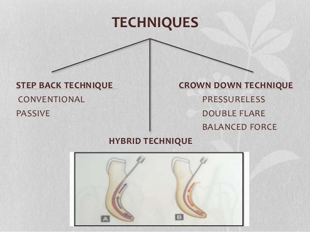 Biomechanical preparation in endodontics