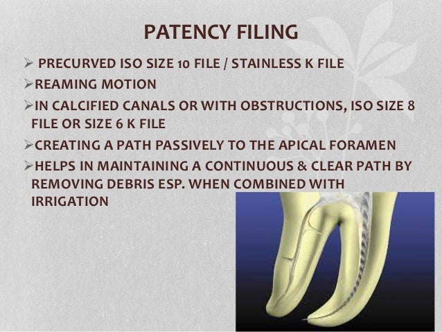 Biomechanical preparation in endodontics