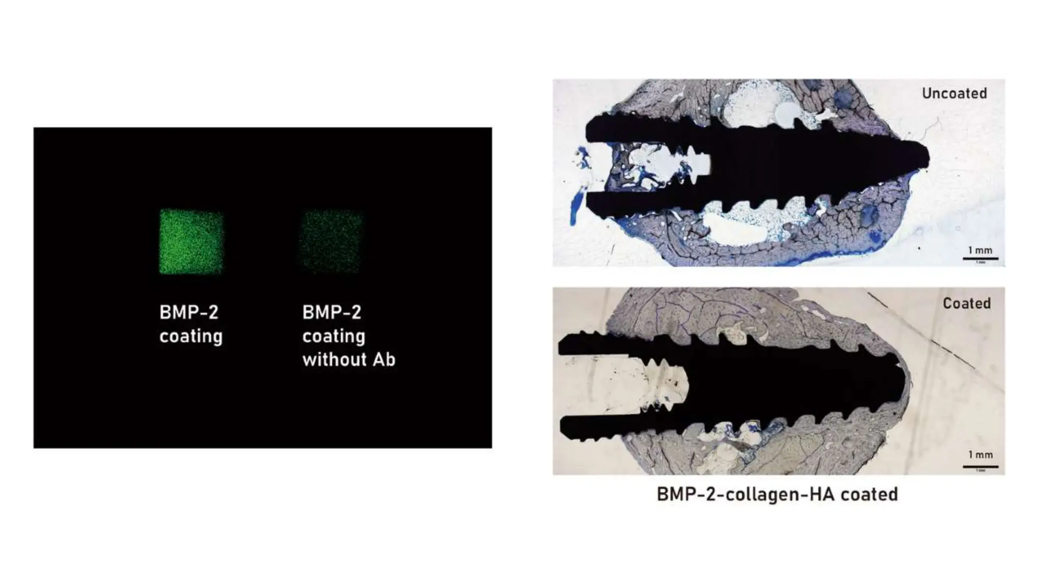 bone morphogenetic protein in periodontics | PPTX