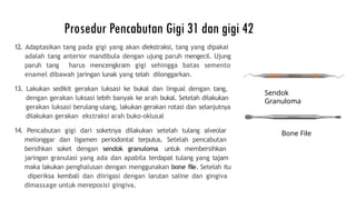 RP CABUTAN GIGI ANTERIOR DAN POSTERIOR BM | PPTX