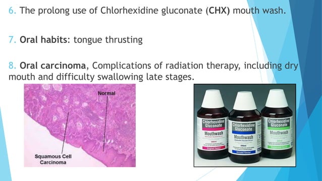 Oral Medicine :Burning mouth syndrome | PPTX | Dental Health | Diseases ...