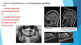 Oral Medicine :Burning mouth syndrome | PPTX