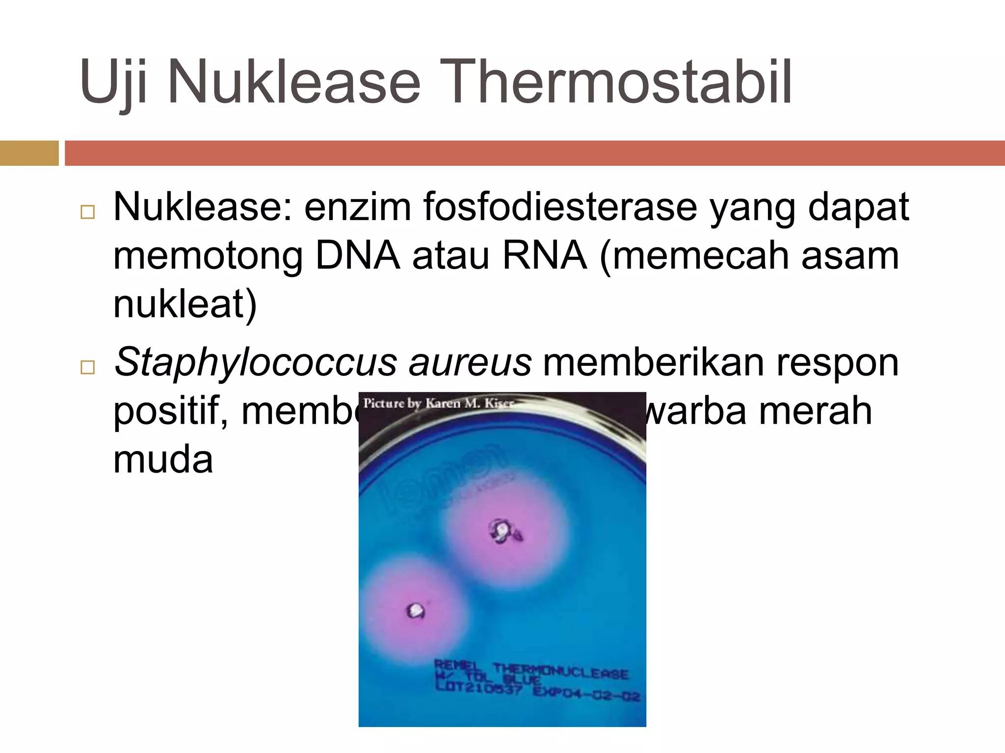 Identifikasi Bakteri Staphylococcus Aureus | PPTX