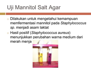 Identifikasi Bakteri Staphylococcus Aureus | PPT