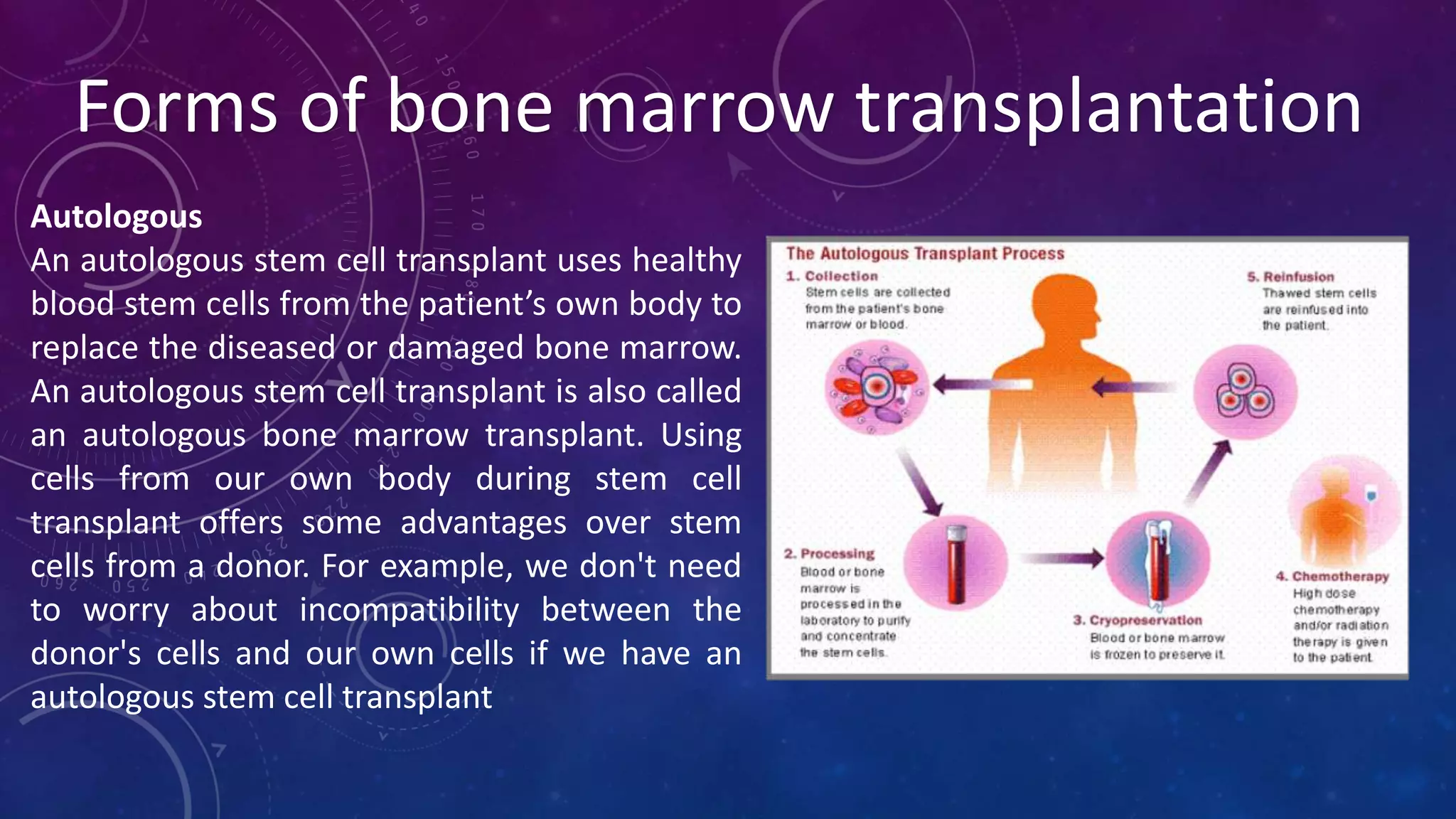 Bone marrow transplant | PPTX