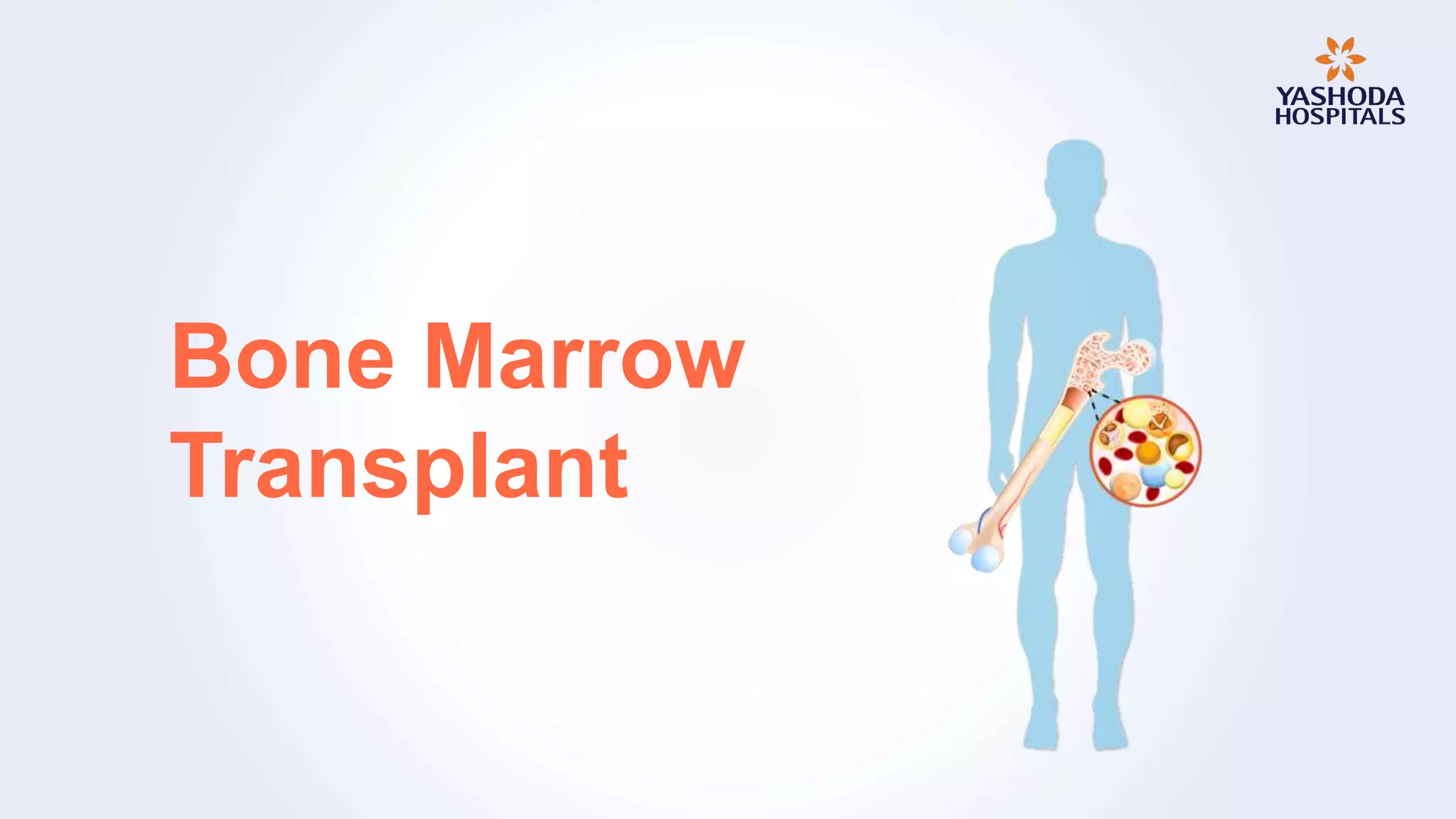 Bone Marrow Transplant in India | Bone Marrow Transplantation in ...