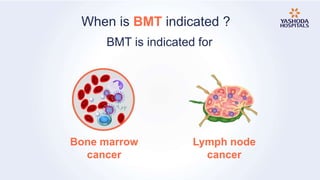Bone Marrow Transplant in India | Bone Marrow Transplantation in ...