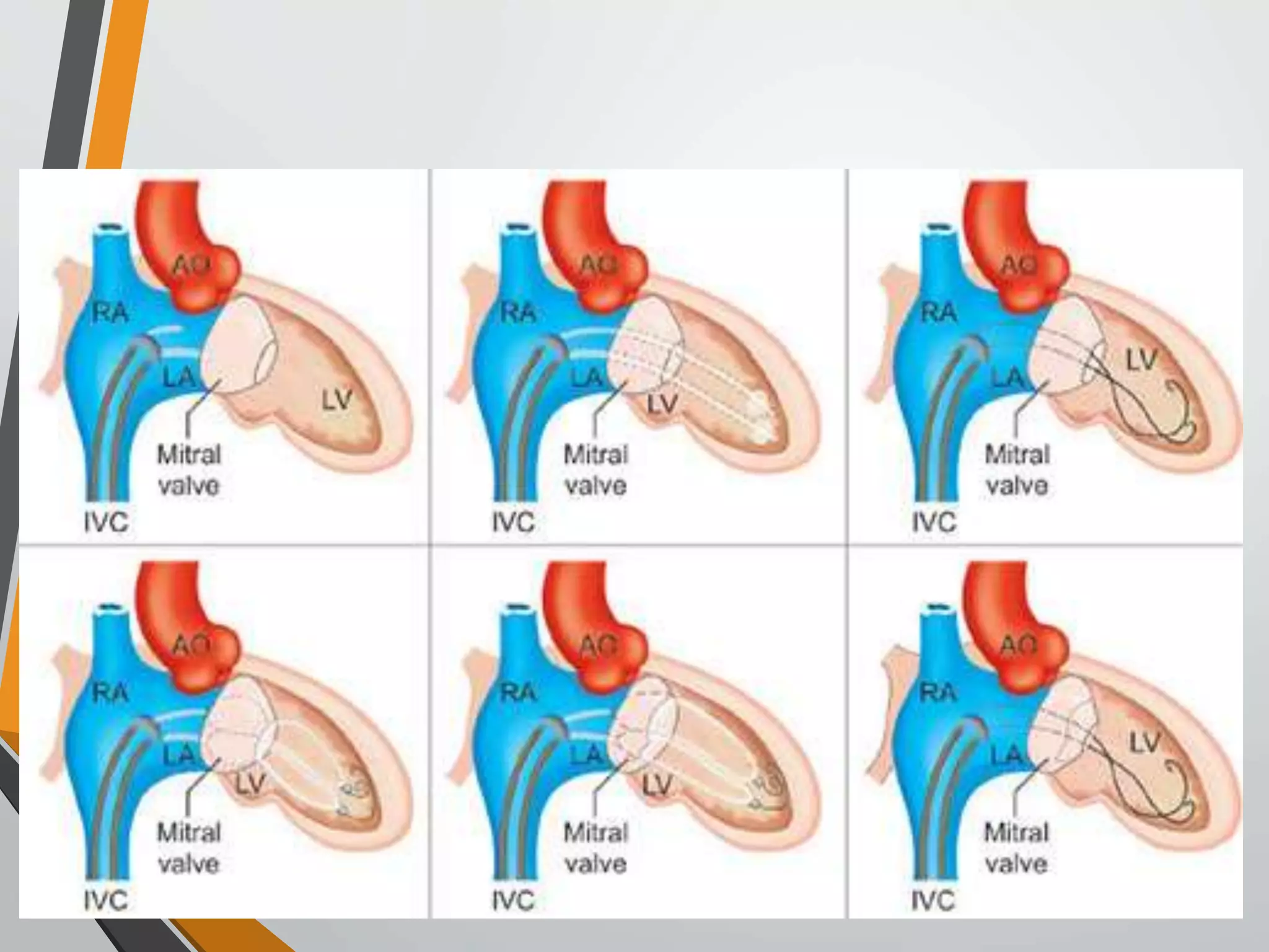 BMV balloons- FINAL.pptx