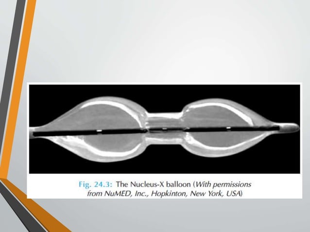 BMV balloons- FINAL.pptx