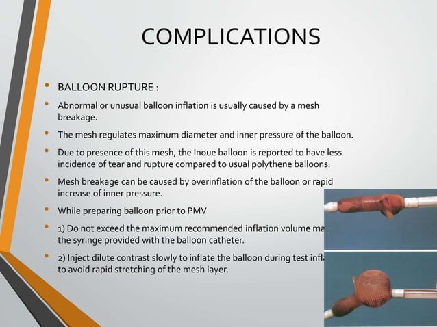 BMV balloons- FINAL.pptx