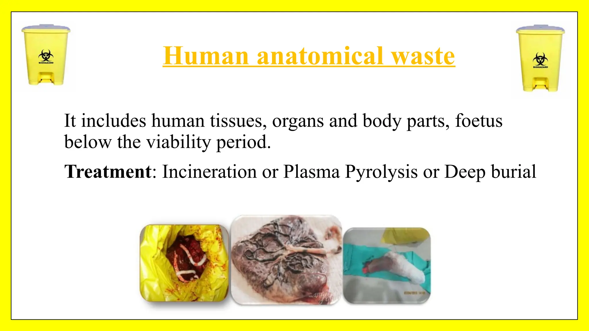 Biomedical waste management ( BMWM) .pptx