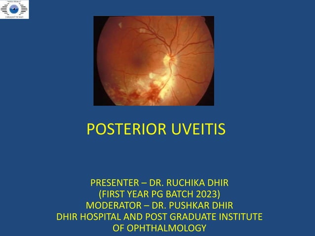 POST_UVEITIS_FINAL resentation dhir hospital bhiwani.pptx