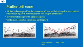 MACULAR_HOLE presentation dhir hospital bhiwani.pptx | Eye and Vision ...