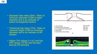 MACULAR_HOLE presentation dhir hospital bhiwani.pptx | Eye and Vision ...