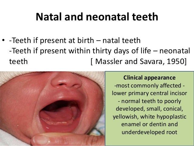 Tooth eruption and shedding - complete package