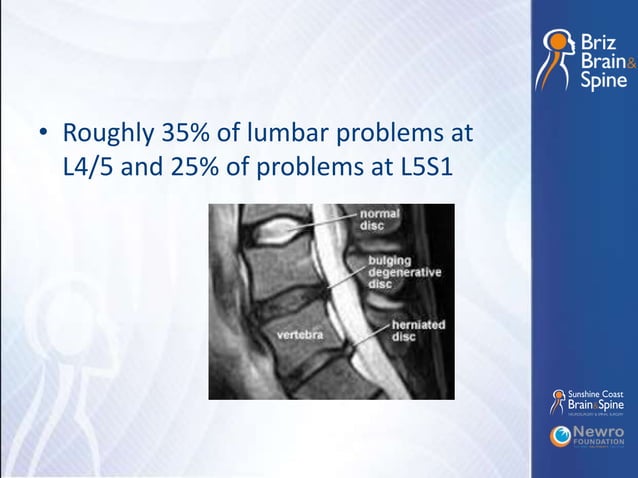 Diagnosing lumbar conditions in primary care | PPTX