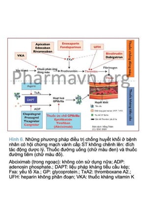 bản FULL hcvc không st chênh.pdf