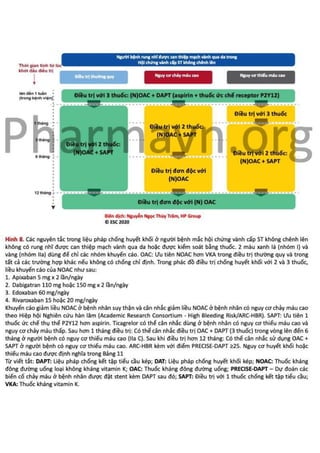 bản FULL hcvc không st chênh.pdf