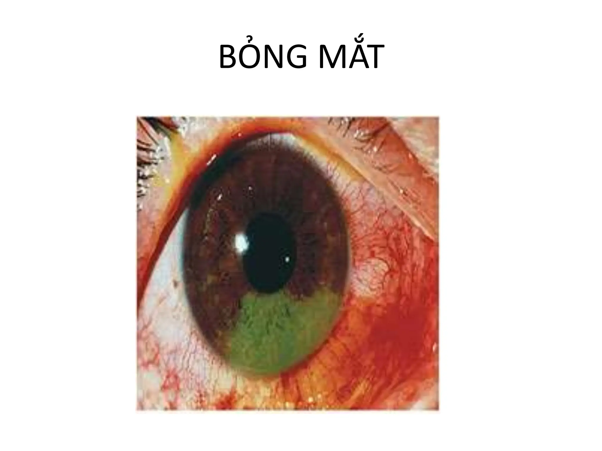 bong mat bong mat bong mat bong mat.pptx