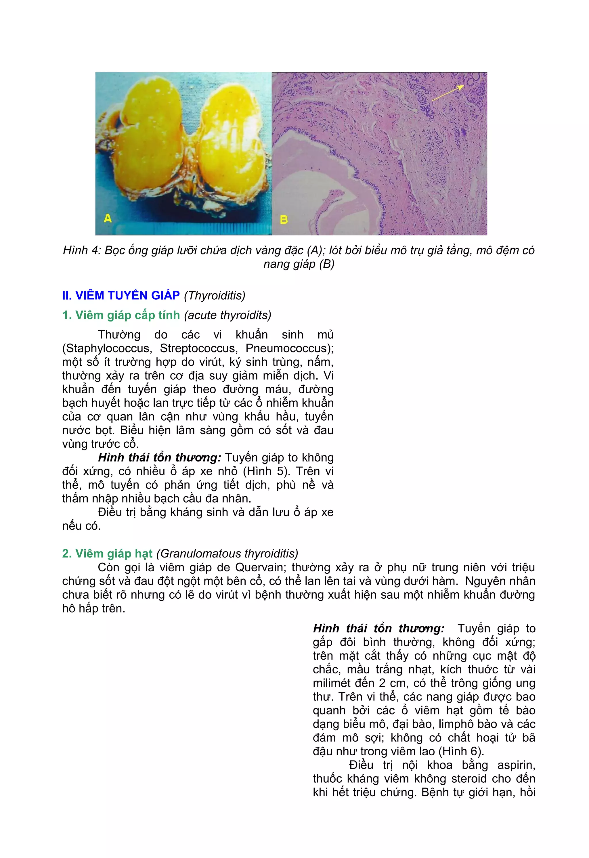 BỆNH LÝ TUYẾN GIÁP | PDF