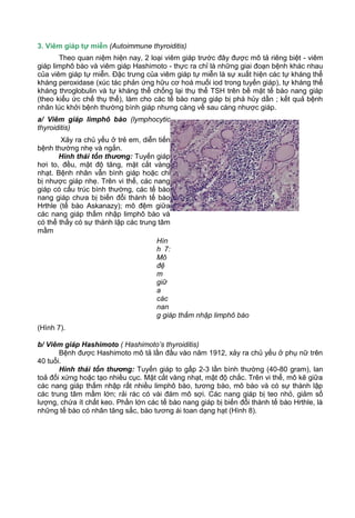 BỆNH LÝ TUYẾN GIÁP | PDF